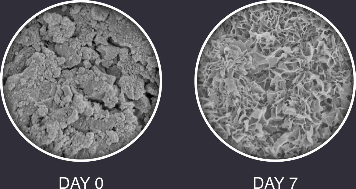 Osteonovus - Surgical Evolution